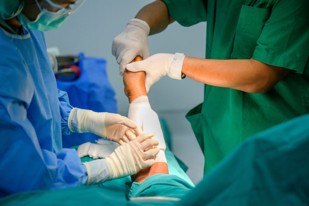 Advanced Hand and Arm Transplant Services | Deepam MediTours